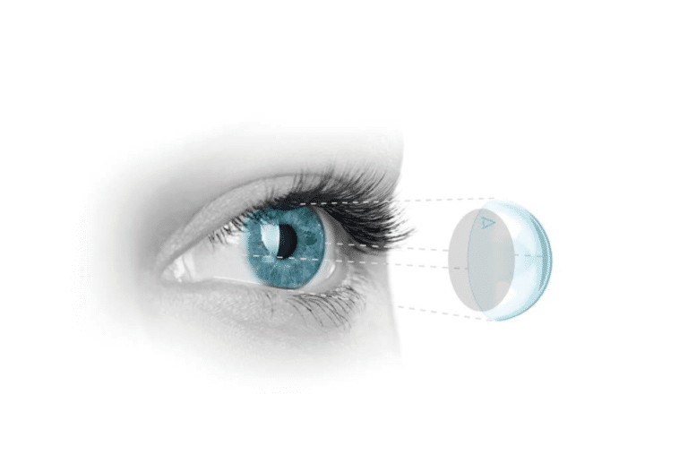 Omnigen - Dry human amniotic membrane-derived matrix