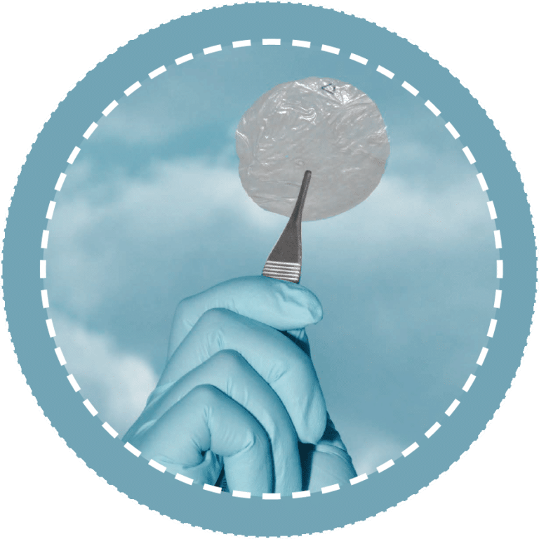 Omnigen - Dry human amniotic membrane-derived matrix